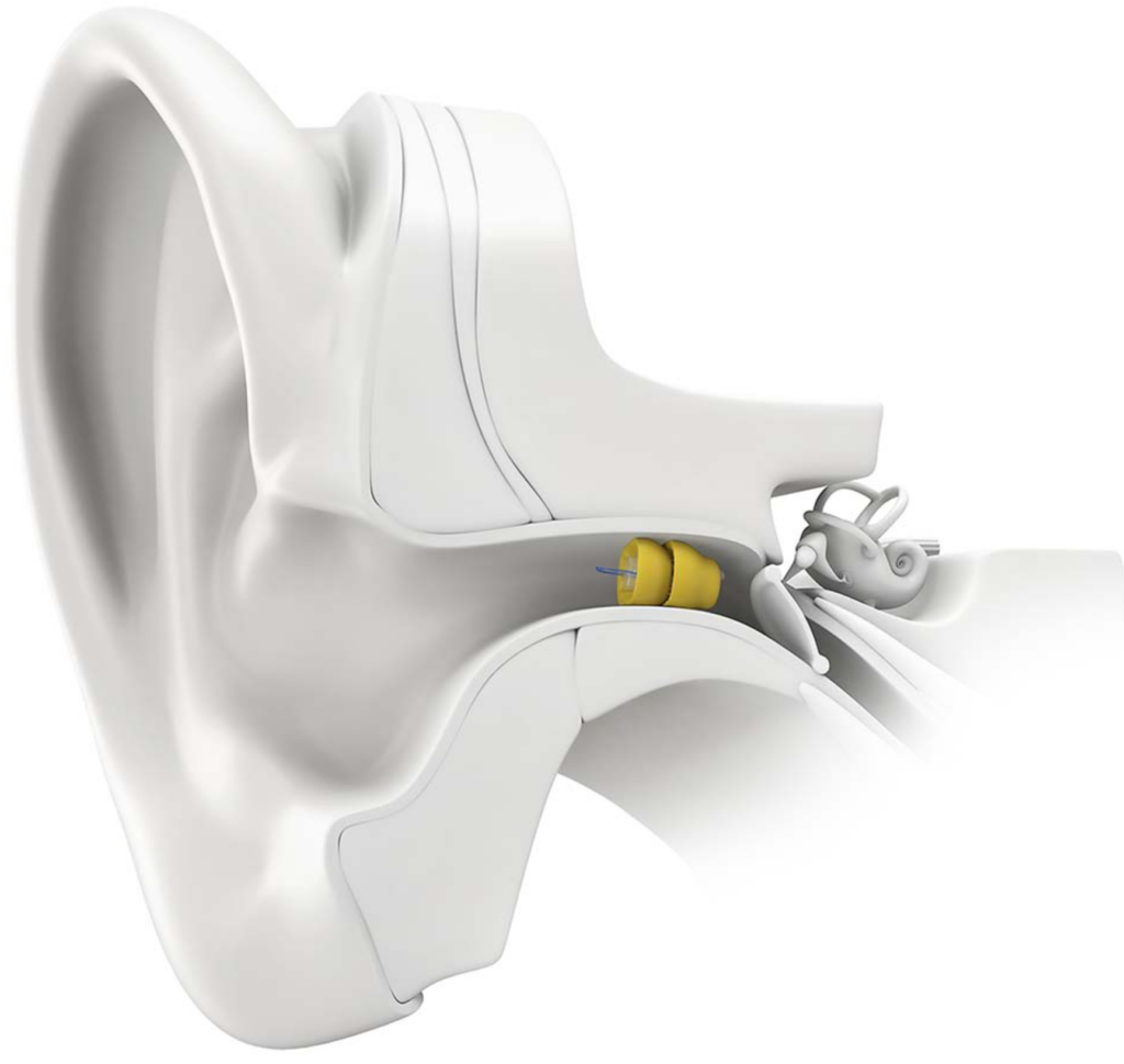 The Hearing Process - Hearing Sense